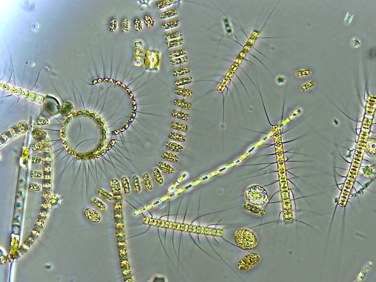 Plankton Are Central to Life on Earth. How Is Climate Change Affecting ...